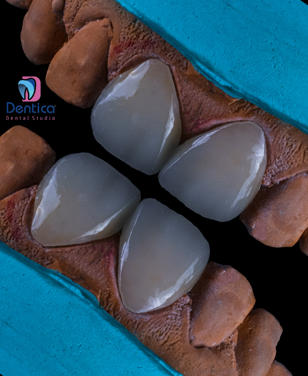 Dentica Dental Studio